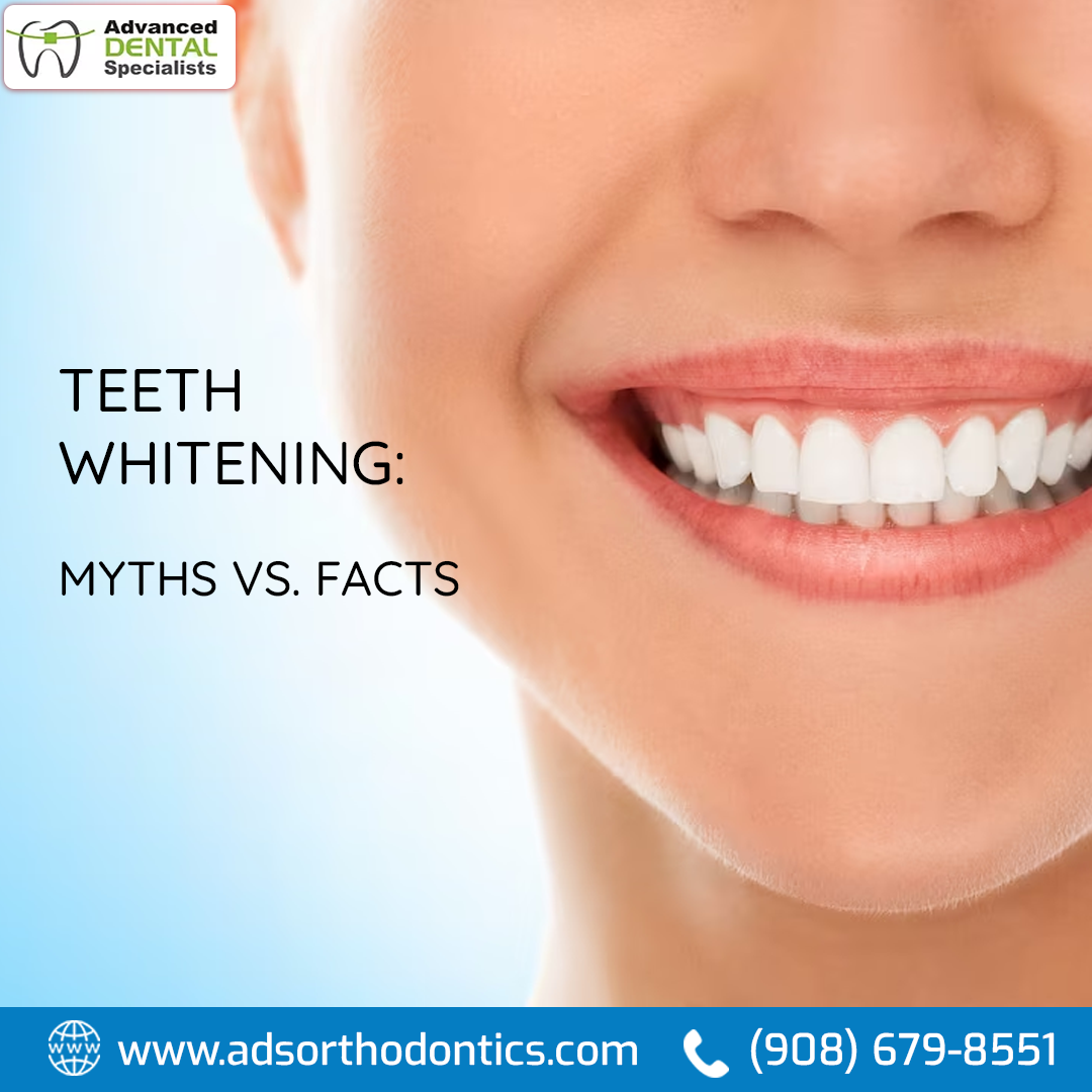 Teeth Whitening: Myths vs. Facts - Adsorthodontics