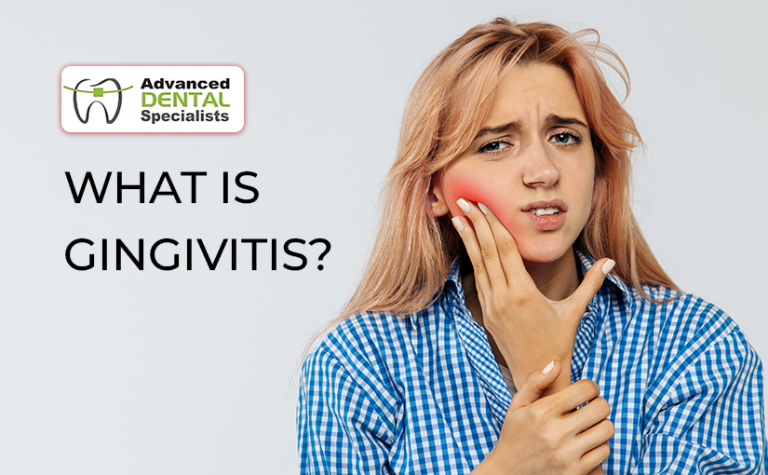 What is Gingivitis?