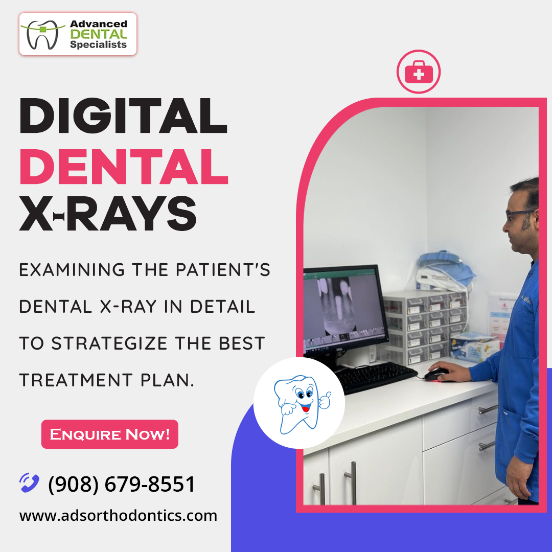 The Advantages of Digital X-Rays in Dentistry - Adsorthodontics